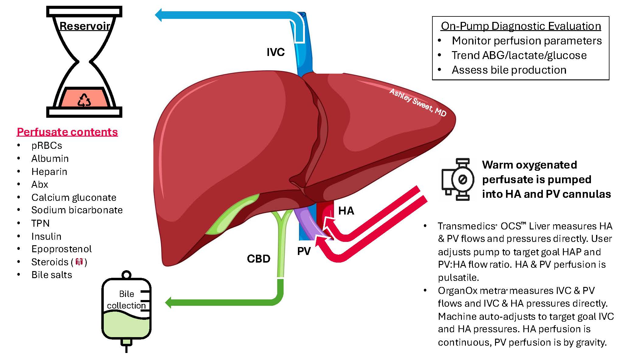 Normothermic Machine Perfusion | AASLD