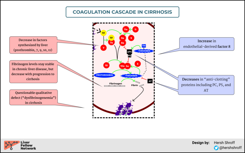 The Coagulopathy of Liver Disease -- Part 2 | AASLD