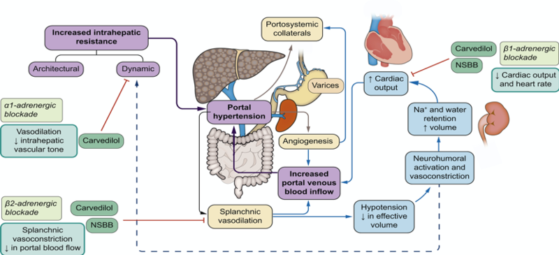 Why do we use non-selective beta-blockers in cirrhosis? - Part 1 | AASLD