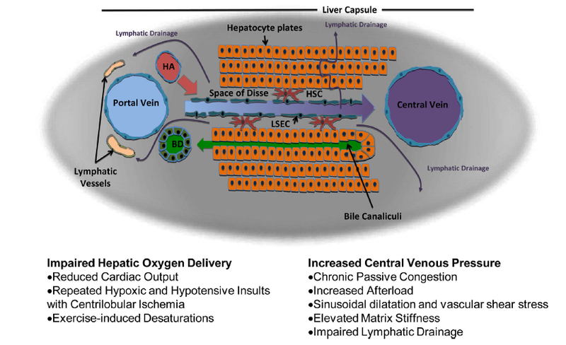 The Cardiology-Hepatology Axis-Fontan Associated Liver Disease | AASLD