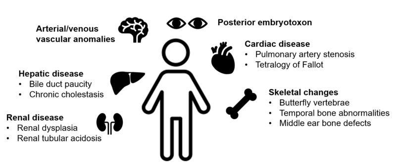 The Real Deal Behind Alagille Syndrome | AASLD